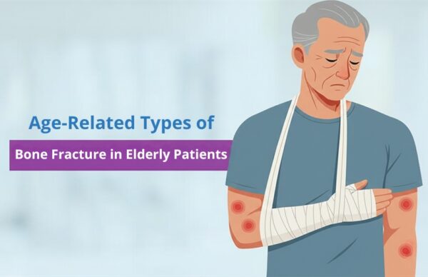 Age-Related Types of Bone Fracture in Elderly Patients